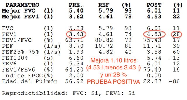 Epoc Broncodilatador